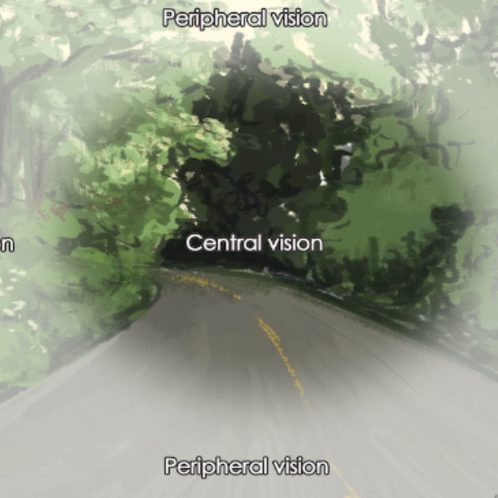 Glaucoma - STAR EYE HOSPITAL